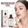 Under 25, Anti-Aging Oil Rosehip Facial SerumVitamin C & E Enriched, Moisturizing Face Oil ...