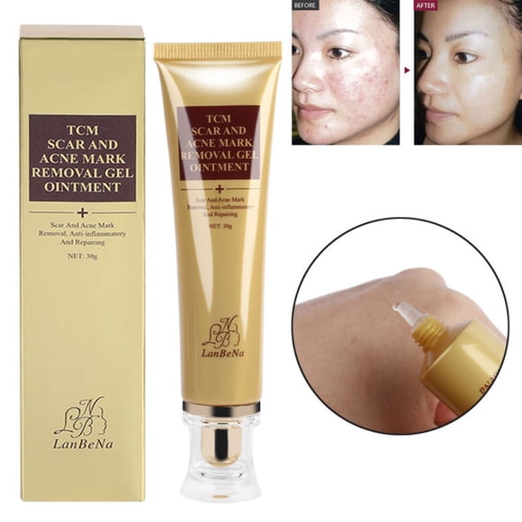 Cyst Removal Cream