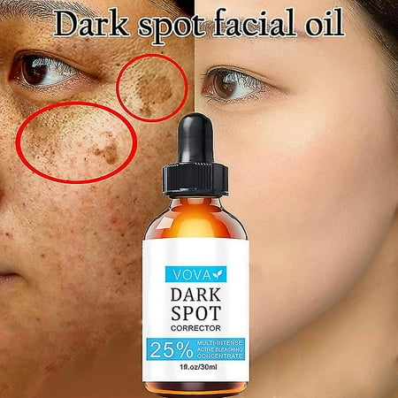 30 ml contre les taches brunes, les sérums pour le visage réduisent les ...