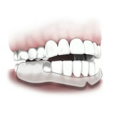 Plackers, Dental Night Guard, 16 ct, Disposable, Ready to Wear ...