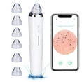 XIRQI 2026 New Blackhead Vacuum Remover with Hd Camera, 6 Suction Heads ...