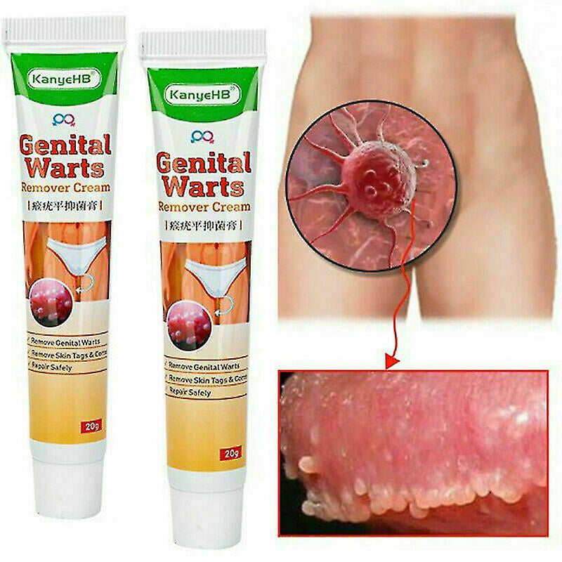 20g Genital Herpe Wart Remover Ungüento Skin Tag Mole Acuminatum Tratamiento kaili Sencillez ...