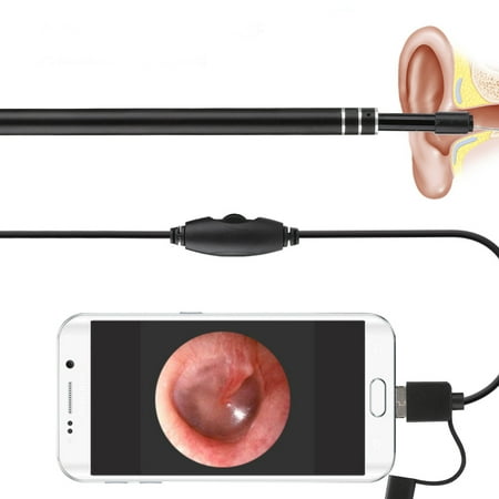 Visible Ear Spoon, Phone Endoscope, HD Ear Scope, Portable System ...