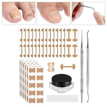 Ingrown Toenail Corrector Stickers Toenail Patch Reusable Patch Toe ...