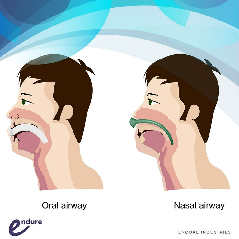 Oropharyngeal Airway And Nasopharyngeal Airway