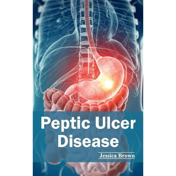 Peptic Ulcer Disease (Hardcover) - Walmart.com