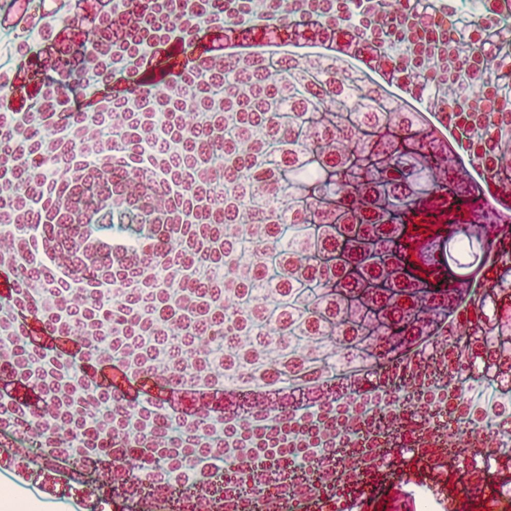 Pinus Ovulate Cone Labeled