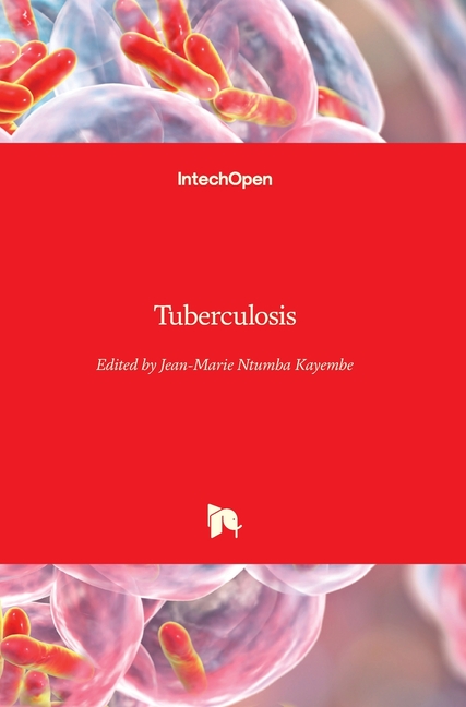 Tuberculosis (Hardcover) - Walmart.com