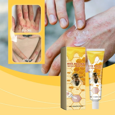 AYA Pommade Antiprurigineuse pour la Peau, Pommade pour Inconfort de la ...