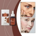 Fair And Lip around Mouth ning Lotion Asian Mens Face Good Skin Care ... Fair And Lip around Mouth ning Lotion Asian Mens Face Good Skin Care ...
