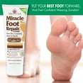 Miracle of Aloe Foot Repair Cream, 8 oz, Relieves Dry Cracked Feet ...