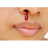 NasalCease First Aid for Cuts & Nosebleeds, 5 Count HSA/FSA Eligible ...