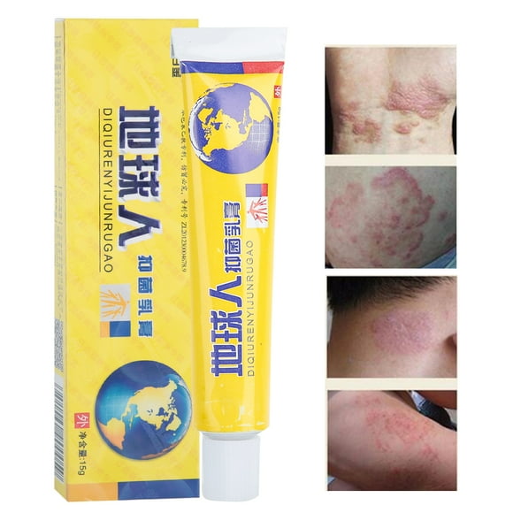 Balanitis Cream