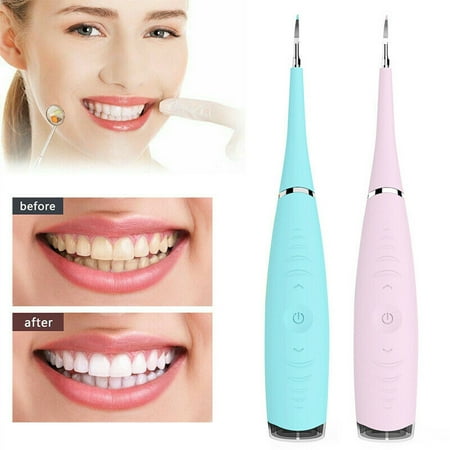 Electric Tooth Cleaner, Electric Dental Calculus RemoverUltrasonic ...