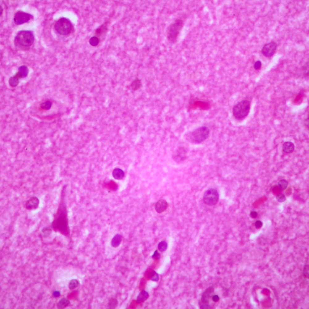 Human Cerebral Cortex, Sec. 7 To 8 M H&E Stain Microscope Slide ...