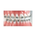 ET Dental MBT 022 Mini Brackets Kit (Non-Extraction) - Walmart.com