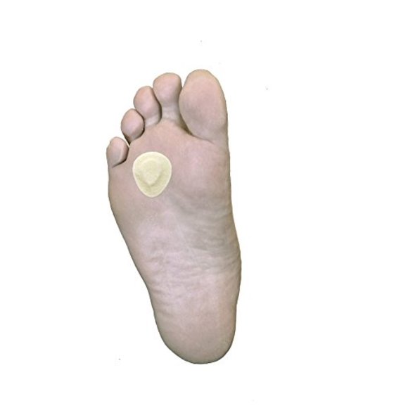 Mortons Neuroma Foot Pads