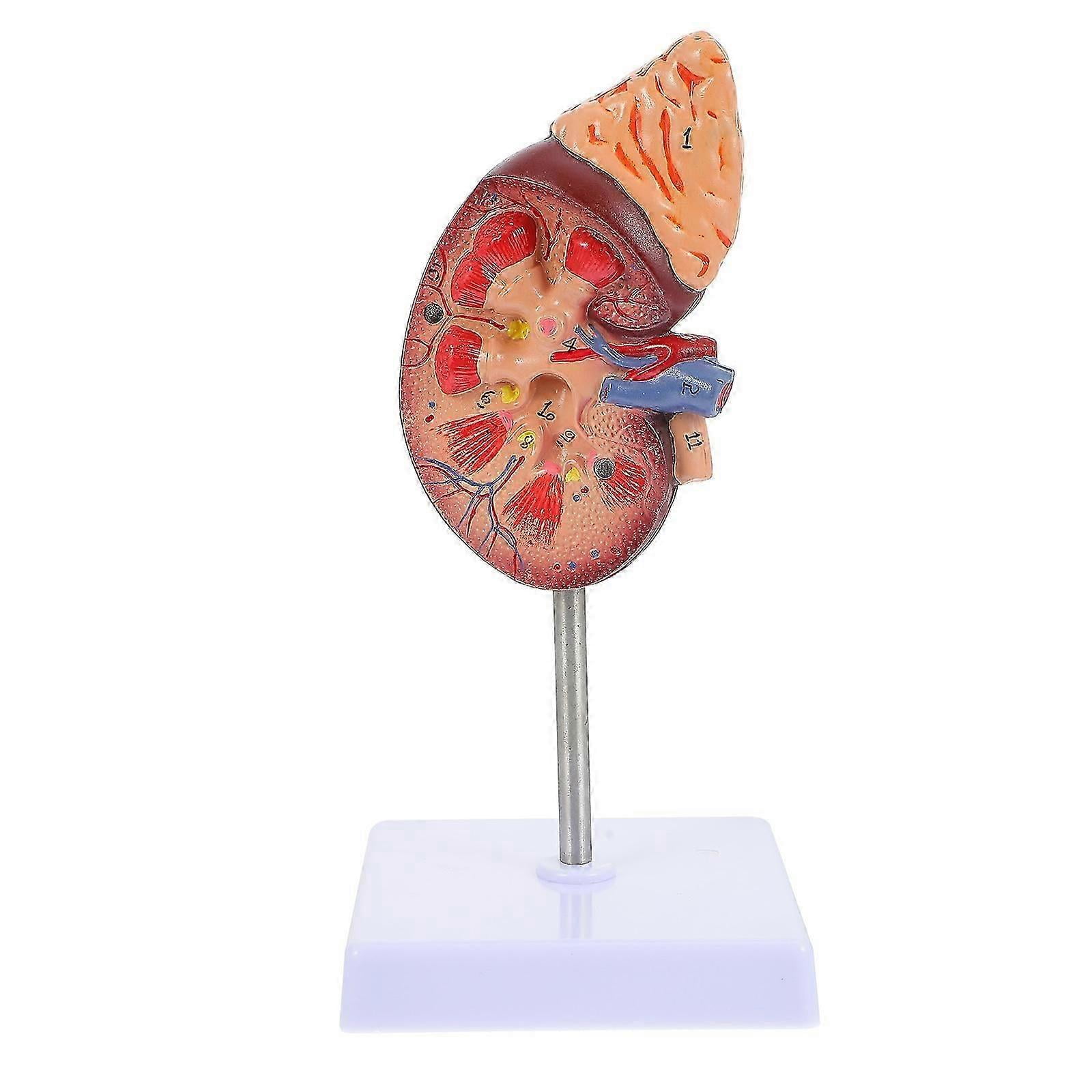 Human Kidney Prop Anatomical Model Biology Class Accessory Kidney Model ...