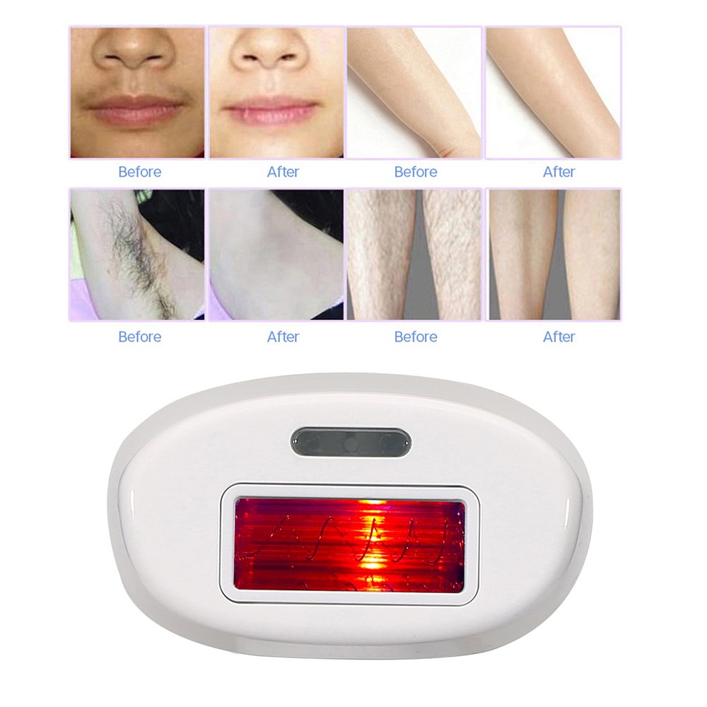 IPL hairless hair removal instrument automatic light energy selection ...