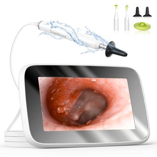 Cynamed Mini Otoscope - Portable Ear Light and Exam Kit for Home and ...