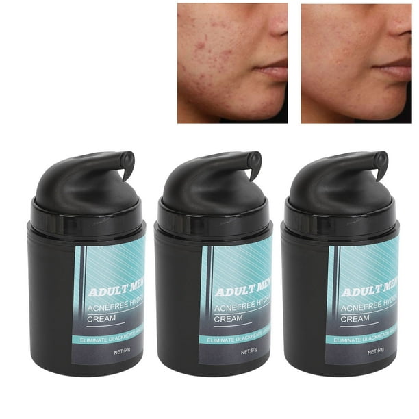 Crema Hidratante Facial Para Hombres, Restaura La Hidratación De La ...