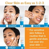 AcneFree Sensitive Skin 24 HR Acne Clearing System, 3 Piece Set HSA/FSA ...