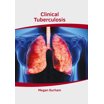 Tuberculosis: A Clinical Guide (Hardcover) - Walmart.com