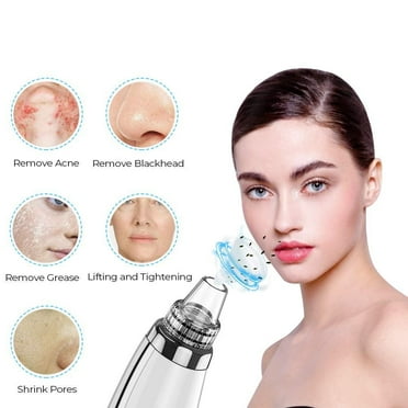 Blackhead Remover Pore Vacuum Cleaner, KROV Electric Rechargeable ...