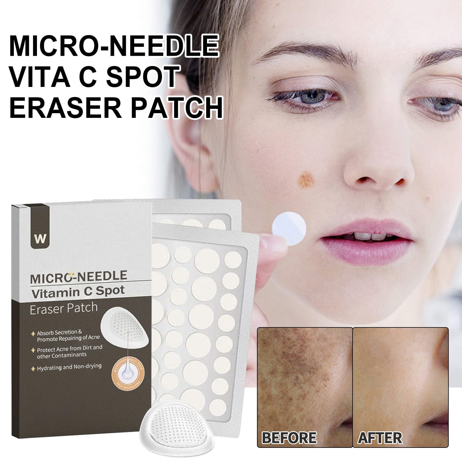 Cara Parches Para Granos Microneedles Secado Parche Cubrir Pegatinas 72 ...