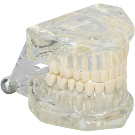 Transparent Dental Model, Dental Teaching Demonstration Teeth Model ...