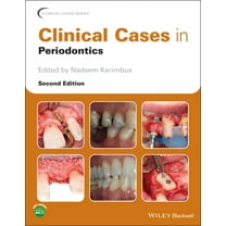 Clinical Cases (Dentistry): Clinical Cases in Dental Hygiene (Paperback ...