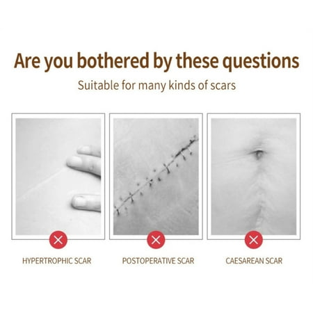 Scar Gel Fading Scar Cream Scar Removal Cream 20g Fading Scar Cream ...