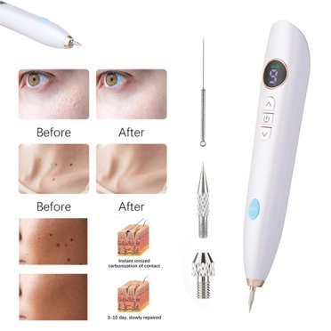 Aristorm Blackhead Remover Vacuum, 5 Modes Pimple Extractor with Camera ...