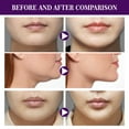 Teissuly Face Lift Tape Instant Face Lift Tape Ultra-thin And High ...