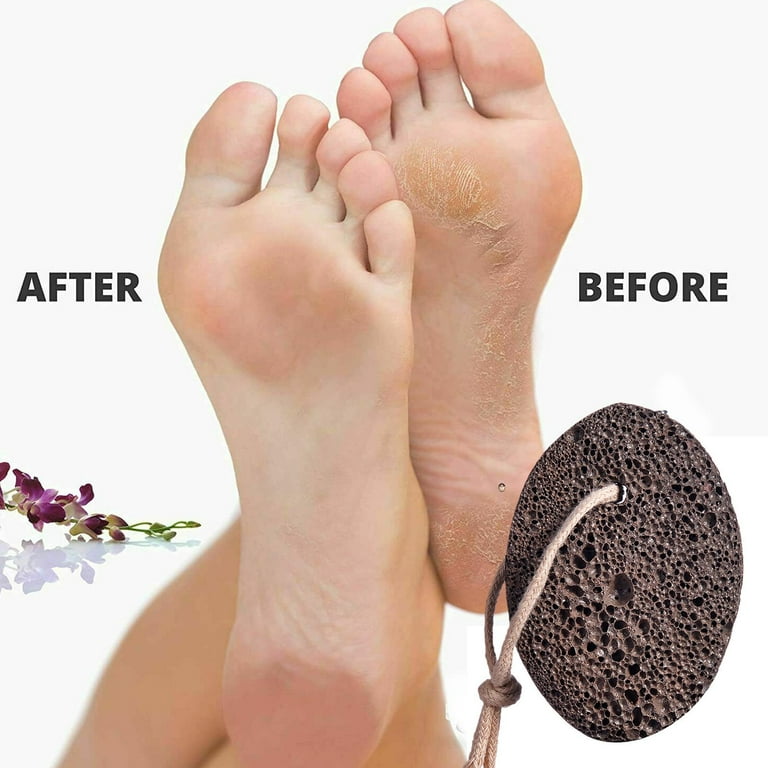 Pumice Stone Before And After
