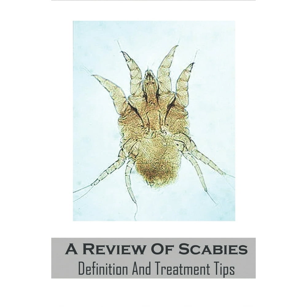 A Review Of Scabies_ Definition And Treatment Tips : Scabies Treatment ...