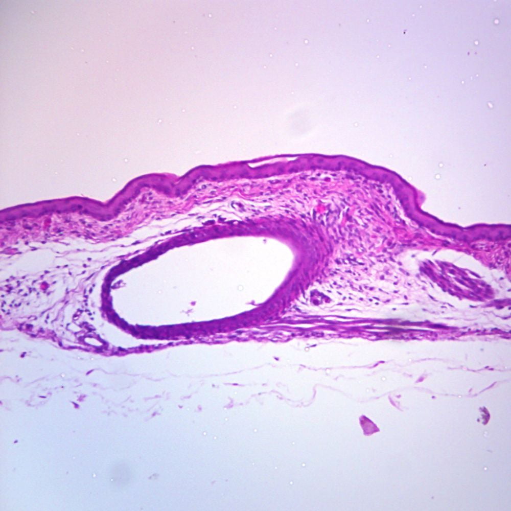 Skin Slide Labeled