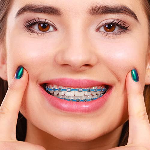 Purple Braces For Teeth