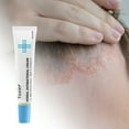 Aurora Trade 20g Herbal Cream Anti Itch Effective Natural Extract Skin Rash Urticaria
