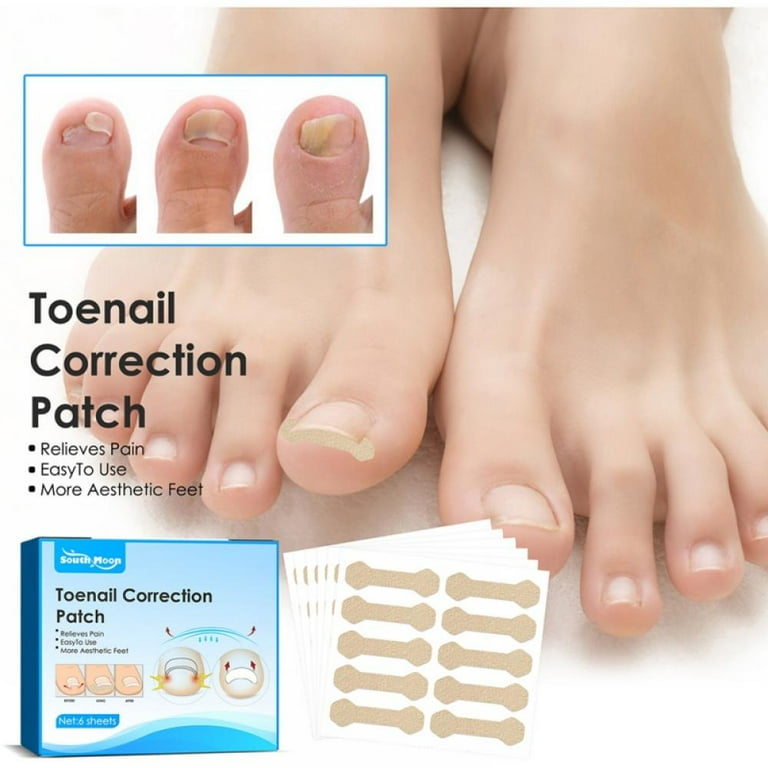 Ingrown Toenail Treatment Cotton
