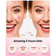 La.Personal Pimple Patches, Pink Heart & Star Shaped, Hydrocolloid with ...