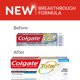 Colgate Total Toothpaste with Fluoride, Multi Benefit Toothpaste with Sensitivity Relief, Deep ...