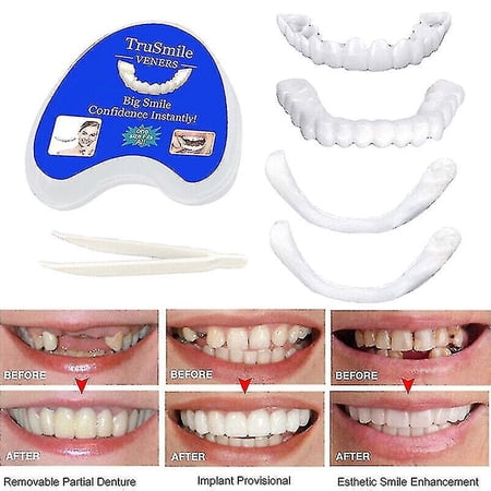SHSLING Smile Snap On False Teeth Upper Lower Dental Veneers Dentures ...