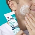 Cerave Acne Foaming Cream Wash With 10 Benzoyl Peroxide For Face