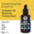 Iq Natural Hair Growth Oil For Men And Women For Natural Stronger