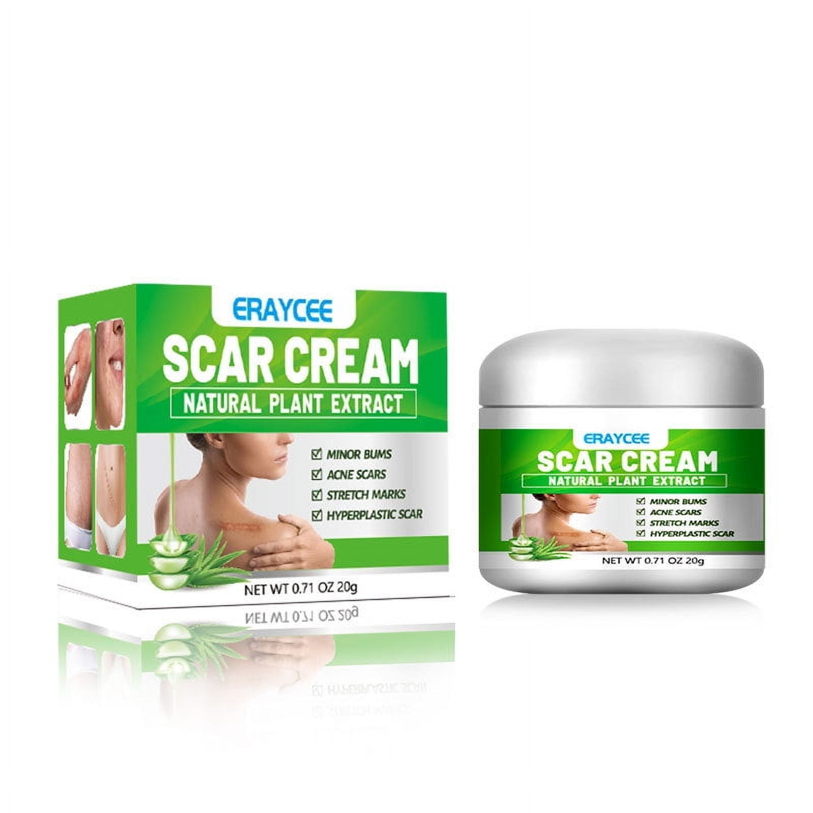 ERAYCEE Natural Aloe Vera Scar Fading Cream for Acne Marks, Burns ...