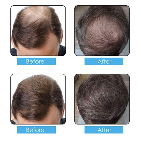 Elaimei Hair Fiber Powder Bagged Densehair Head Natural Densification ...