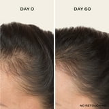 John Frieda ULTRAfiller+ Hair Density Scalp Serum for Fine Hair, Scalp ...