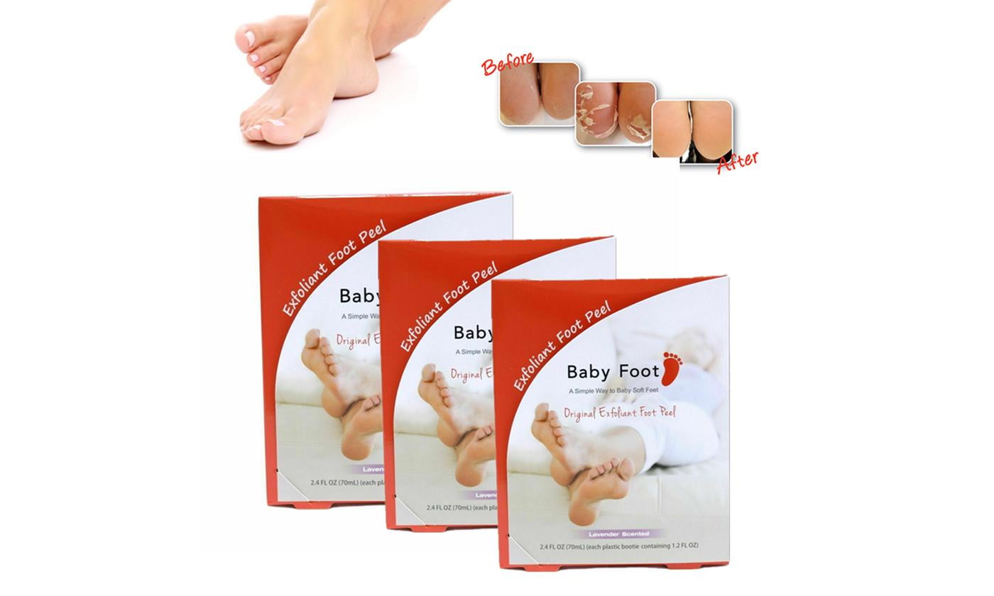 Baby Foot - Original Exfoliant Foot Peel - 2.4 Fl. Oz. Lavender Scented ...