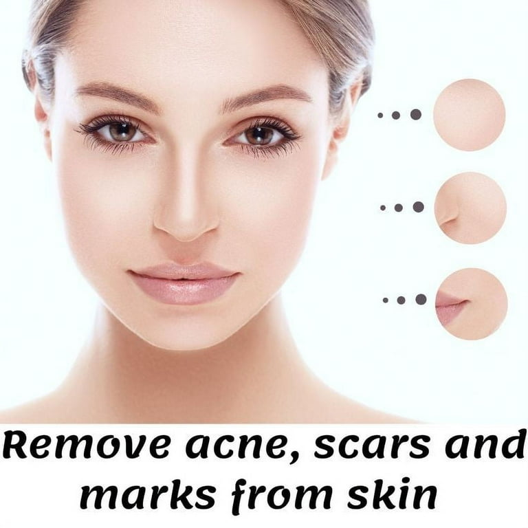 Celebrity Acne Scars